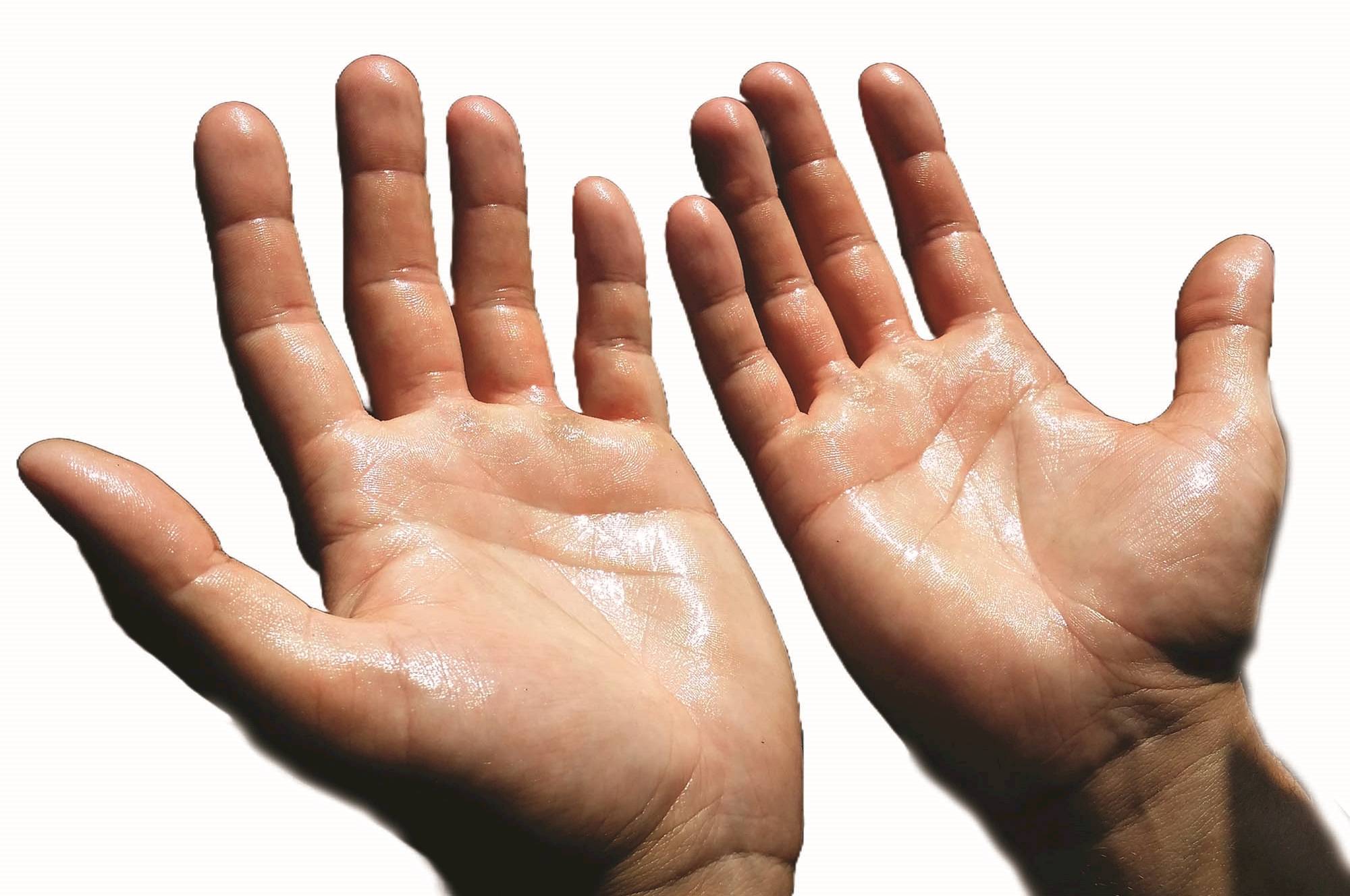 End of sweating anywhere on the body | www.iontophoresis.com